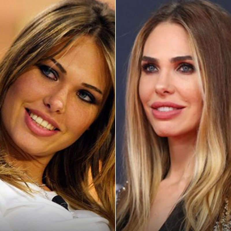 Questa era Ilary Blasi prima.......è DOPO Il ritocco chirurgico è ...